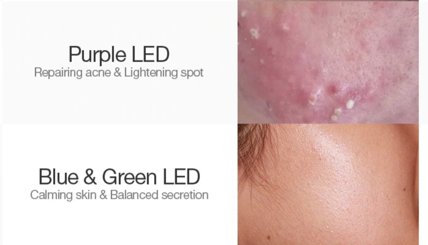 LED Light Therapy Facial - L'Exquisite Day Spa For Women & Men