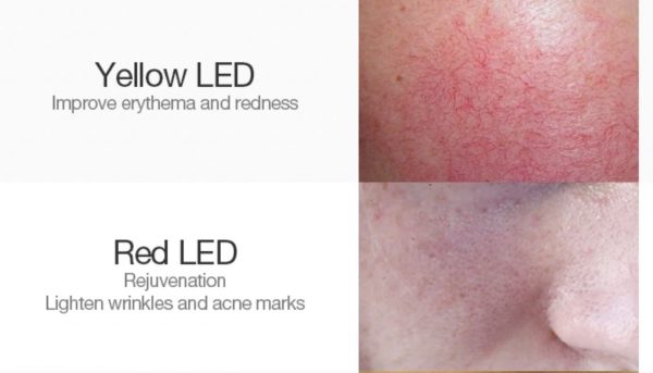 LED Light Therapy Facial - L'Exquisite Day Spa For Women & Men